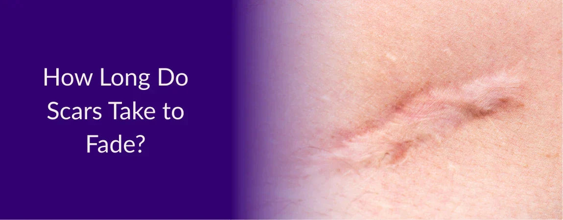 How Long Do Scars Take to Fade? Tips & Treatments for Scar Healing ...
